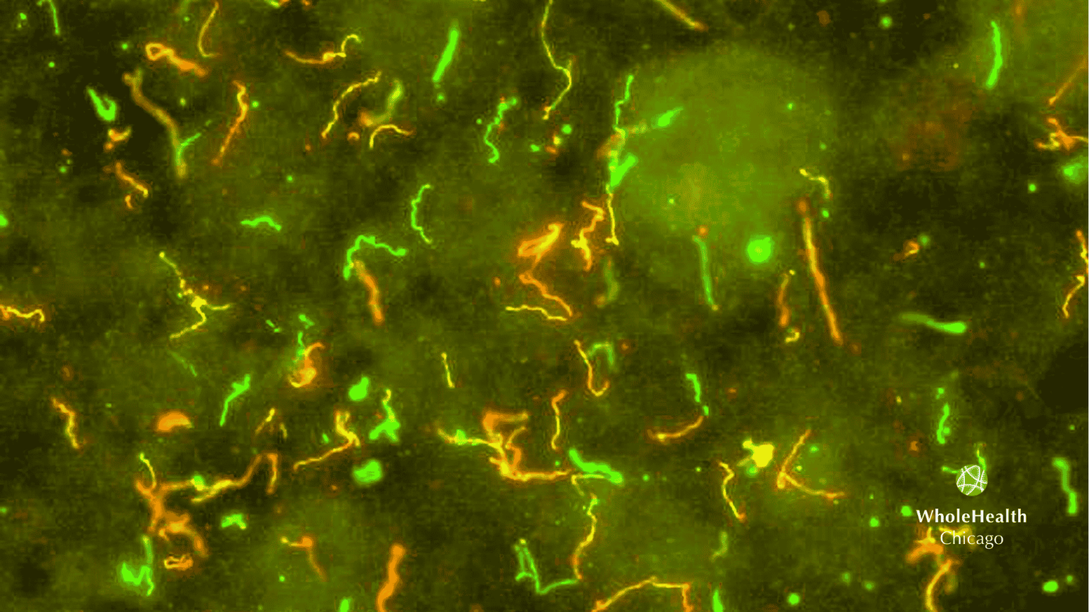 Lyme Disease: Real or All in Your Head?